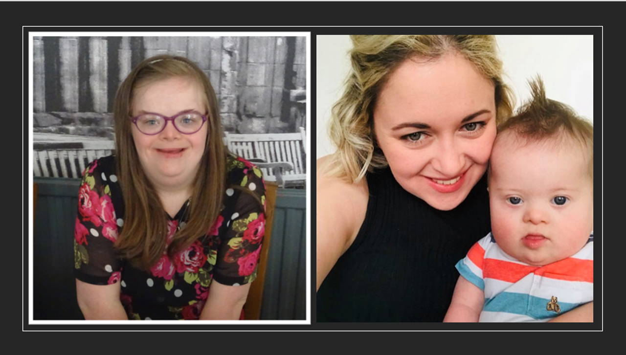 Downright discrimination: stop the govt singling out disabled babies